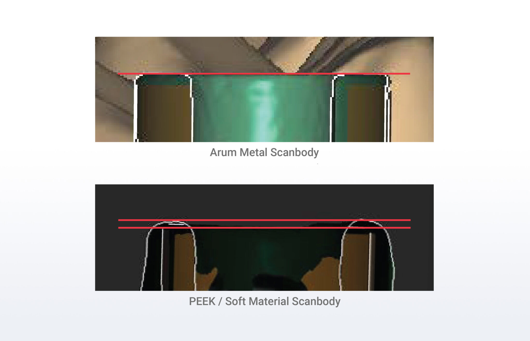 Model | Intraoral Scanbody - ARUM DENTAL